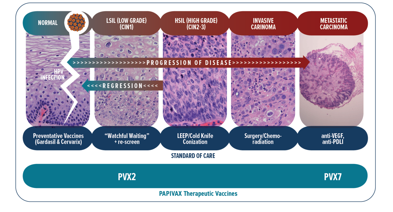 From Precursor Lesion to HPV-Associated Cancer - PapiVax Biotech, inc.